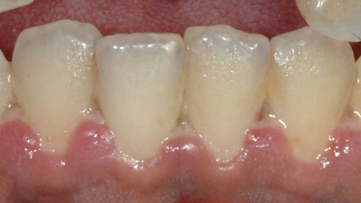 10 things you didn't know you can do with a lemon